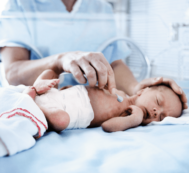 Principles of transcutaneous monitoring - Radiometer